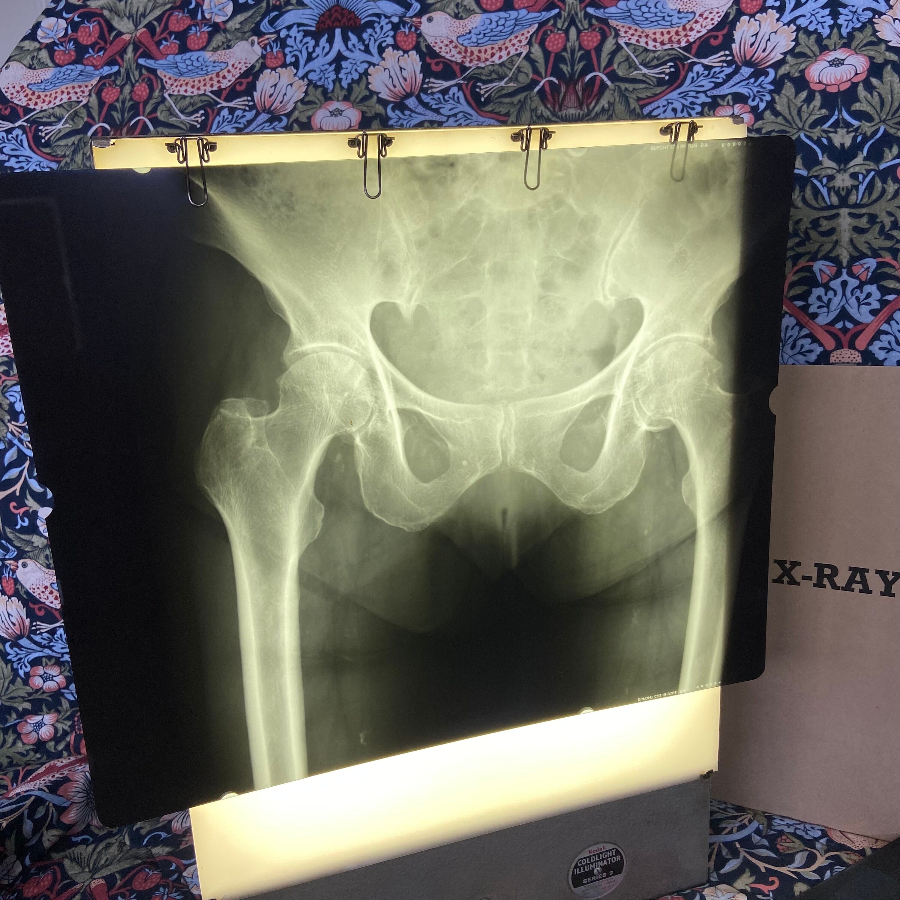 10x X-rays RARE ORIGINAL Hospital Medical X-rays Real Scientific ...