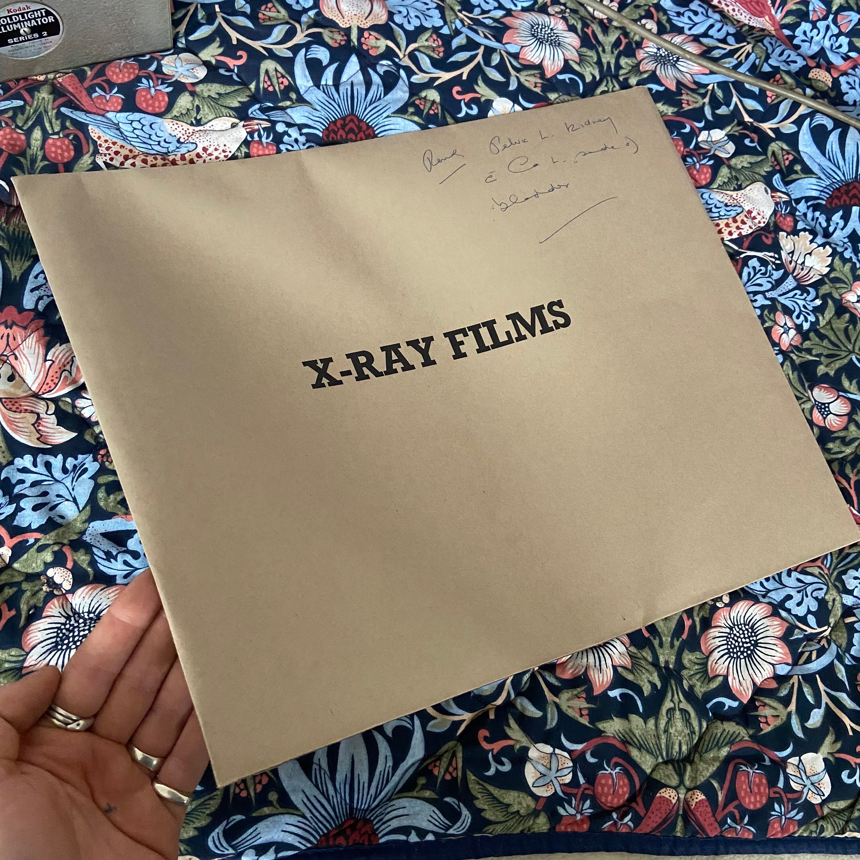 10x X-rays RARE ORIGINAL Hospital Medical X-rays Real Scientific ...