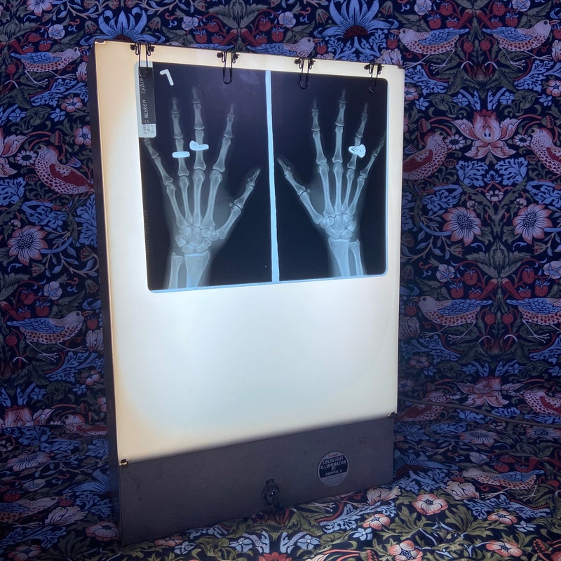 X Ray - Etsy