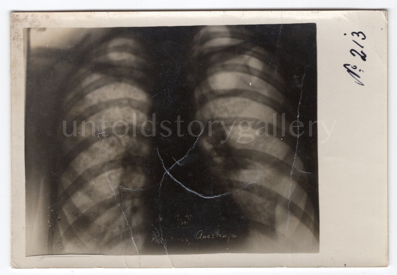 Vintage X-ray, Found Photo - Etsy