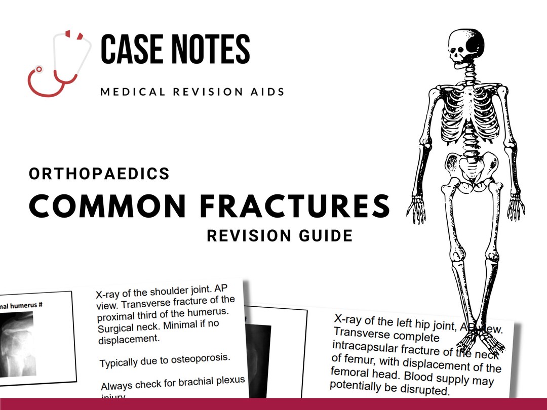 Orthopaedics Fractures Study Notes Case Notes Revision Aids High Yield ...