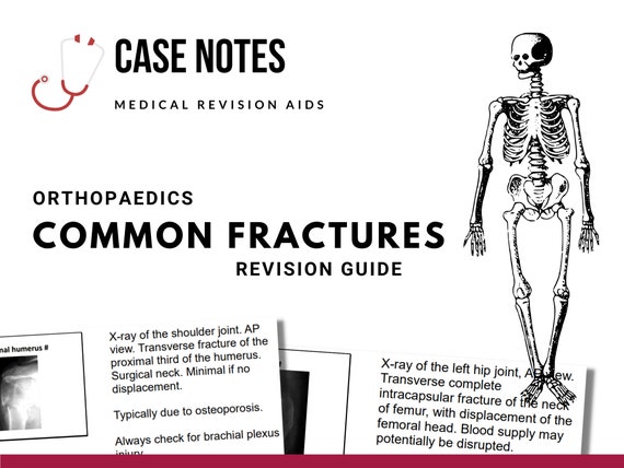 Orthopaedics Fractures Study Notes Case Notes Revision Aids - Etsy