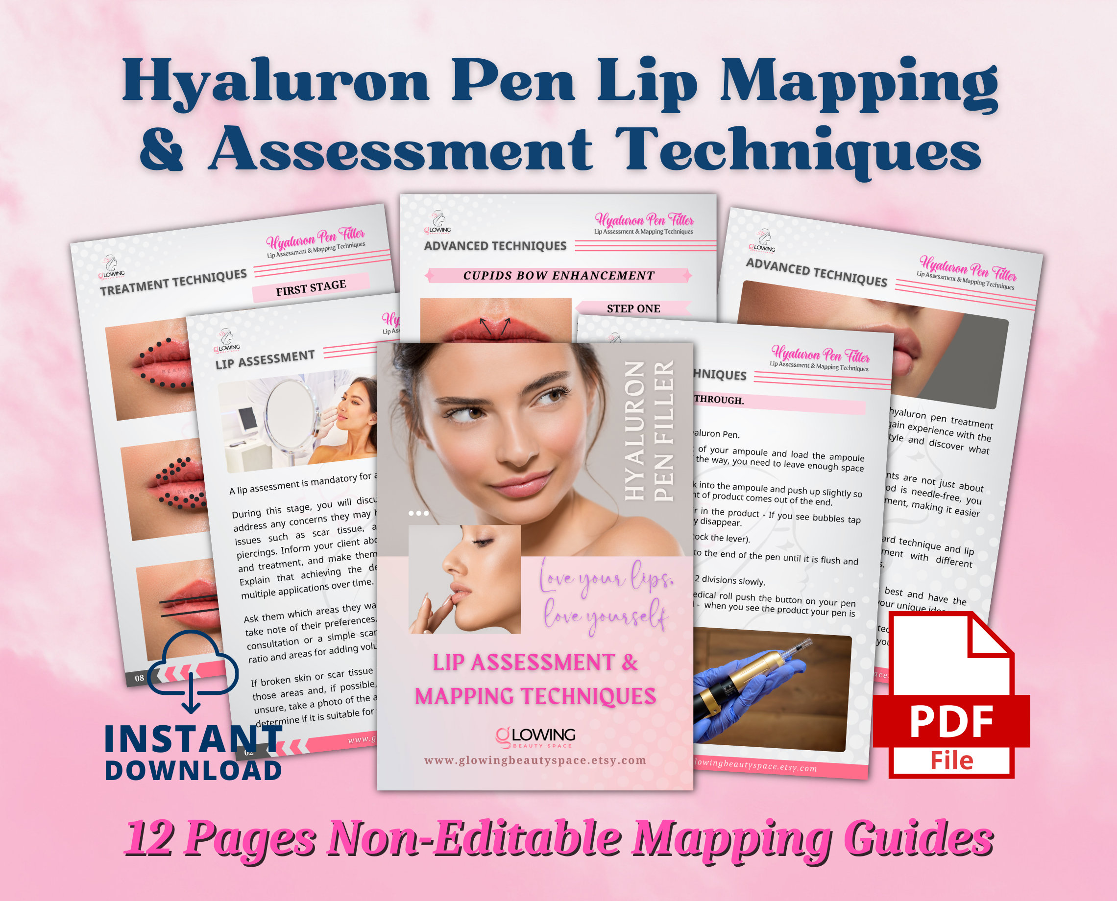 Lip Mapping, Hyaluron Pen Lip Mapping Techniques, Lip Filler Mapping ...