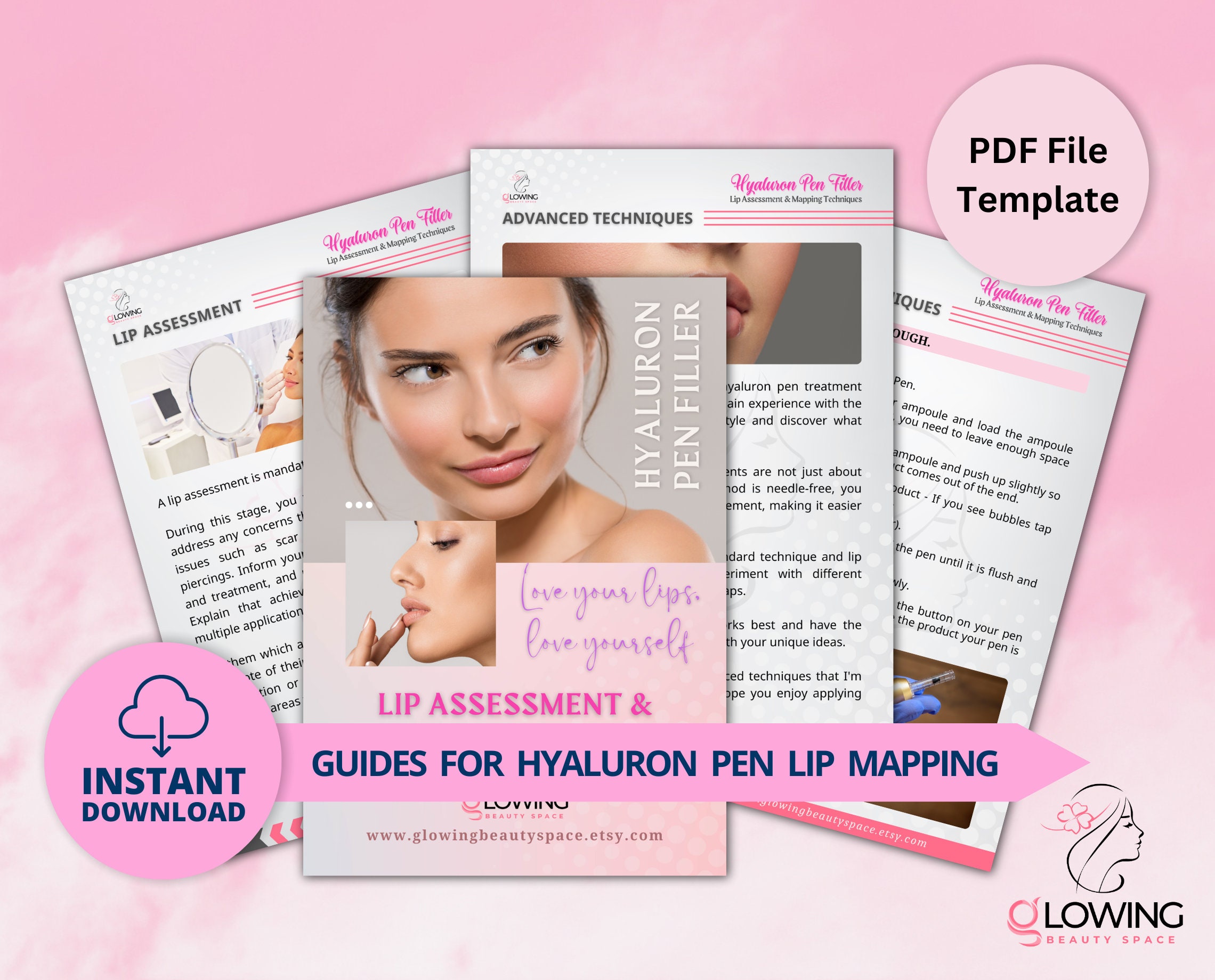 Lip Mapping, Hyaluron Pen Lip Mapping Techniques, Lip Filler Mapping ...