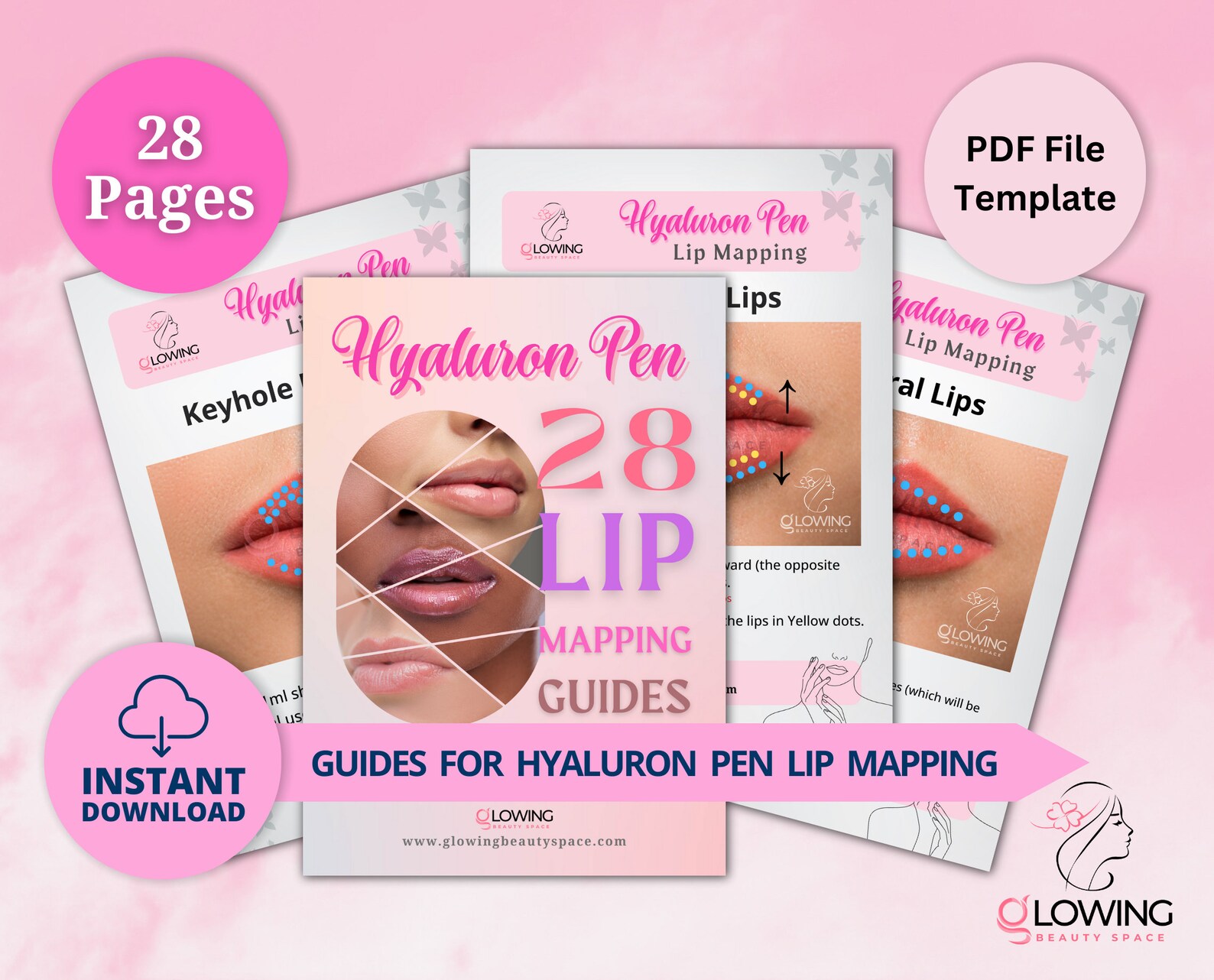 Hyaluron Pen Lip Mapping, Lip Filler Mapping, Lip Mapping Training ...