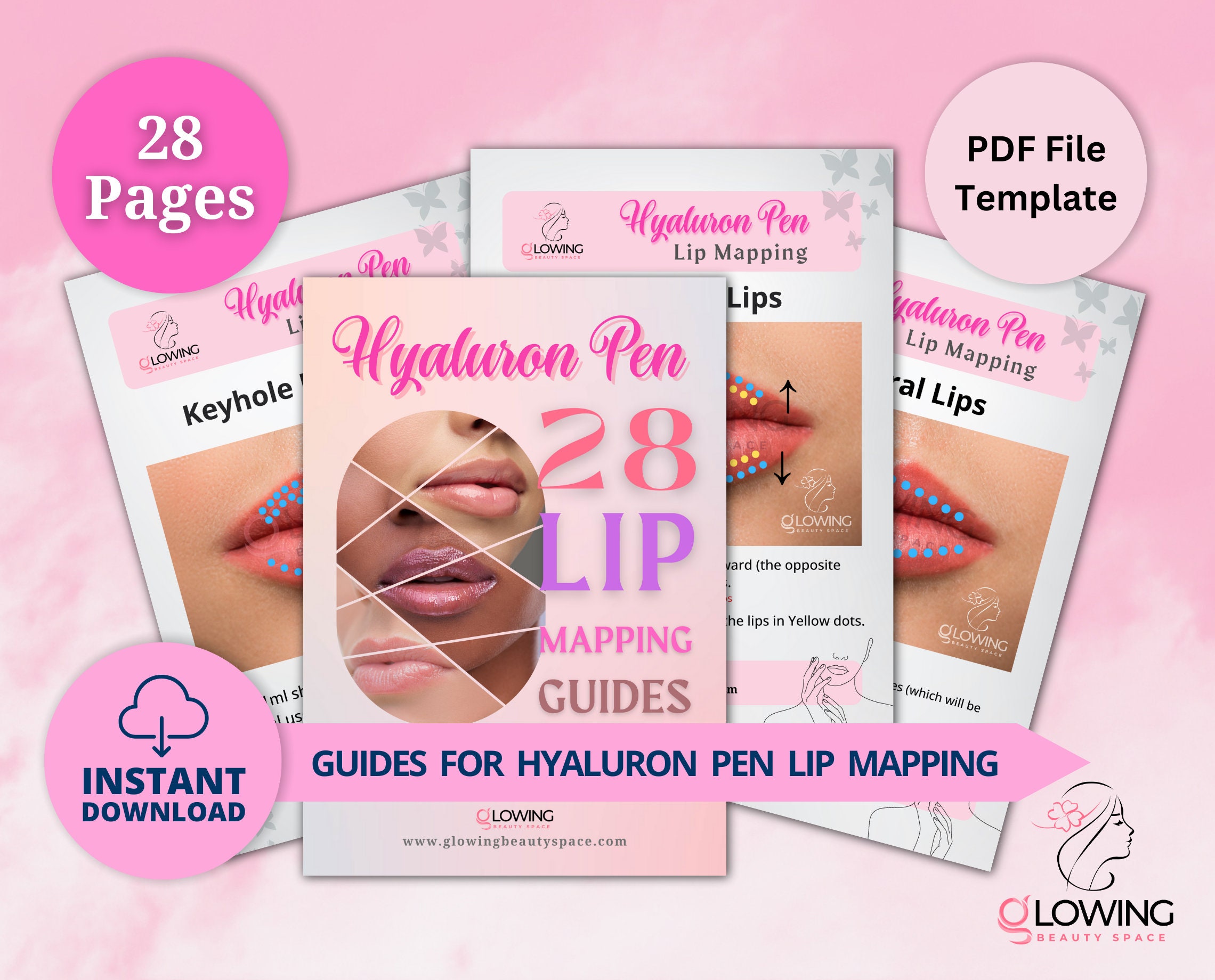 Hyaluron Pen Lip Mapping, Lip Filler Mapping, Lip Mapping Training ...