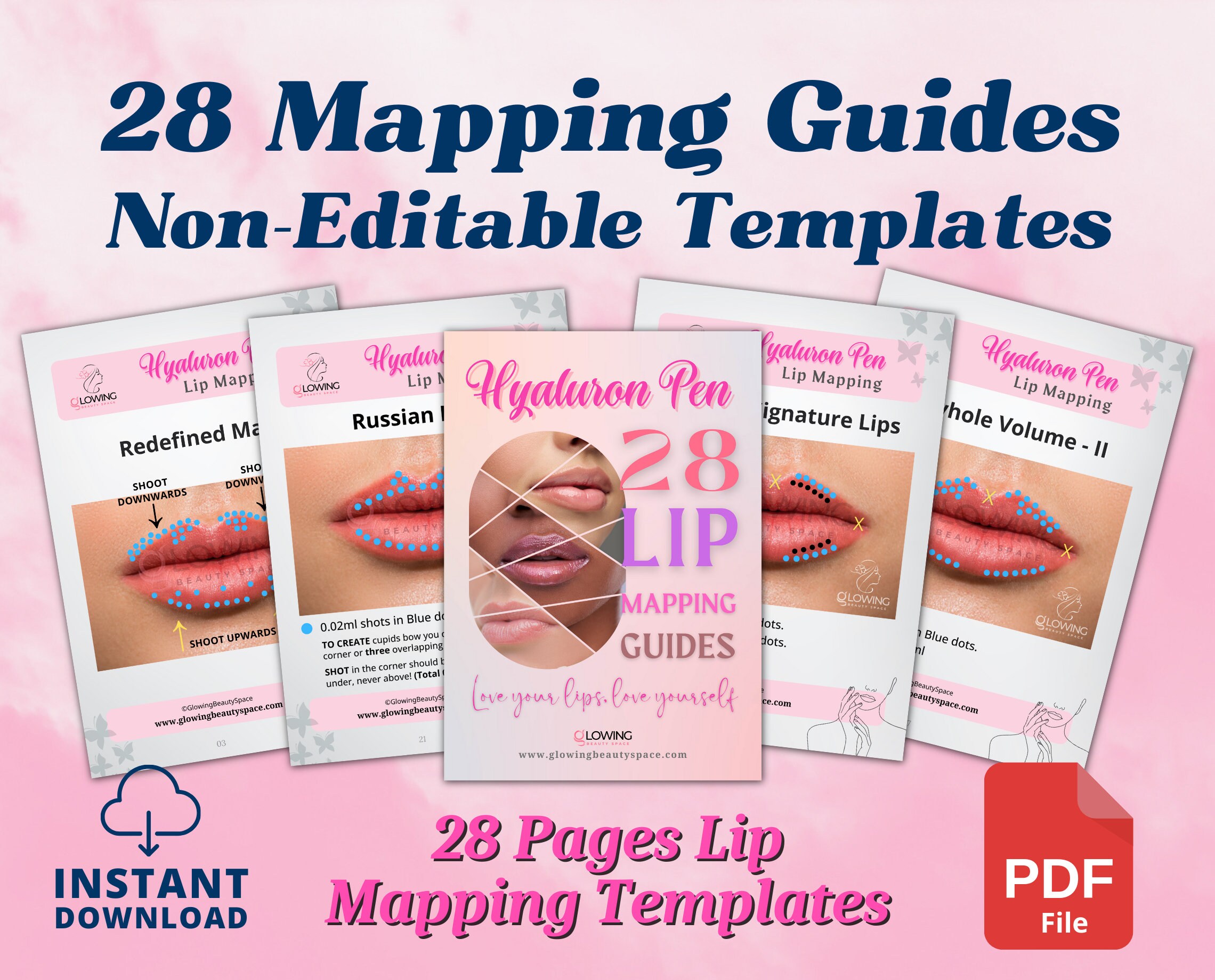 Hyaluron Pen Lip Mapping, Lip Filler Mapping, Lip Mapping Training ...