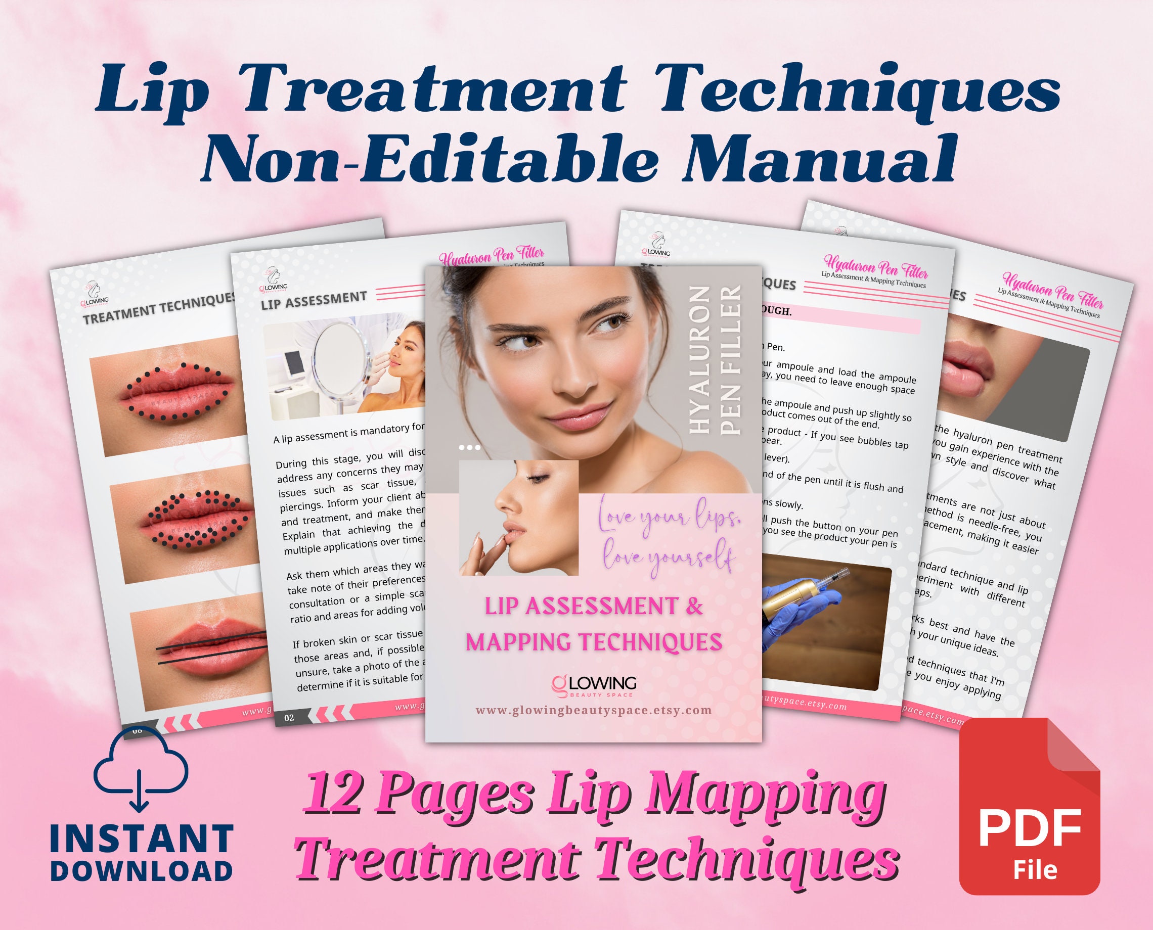 Lip Mapping, Hyaluron Pen Lip Mapping Techniques, Lip Filler Mapping ...