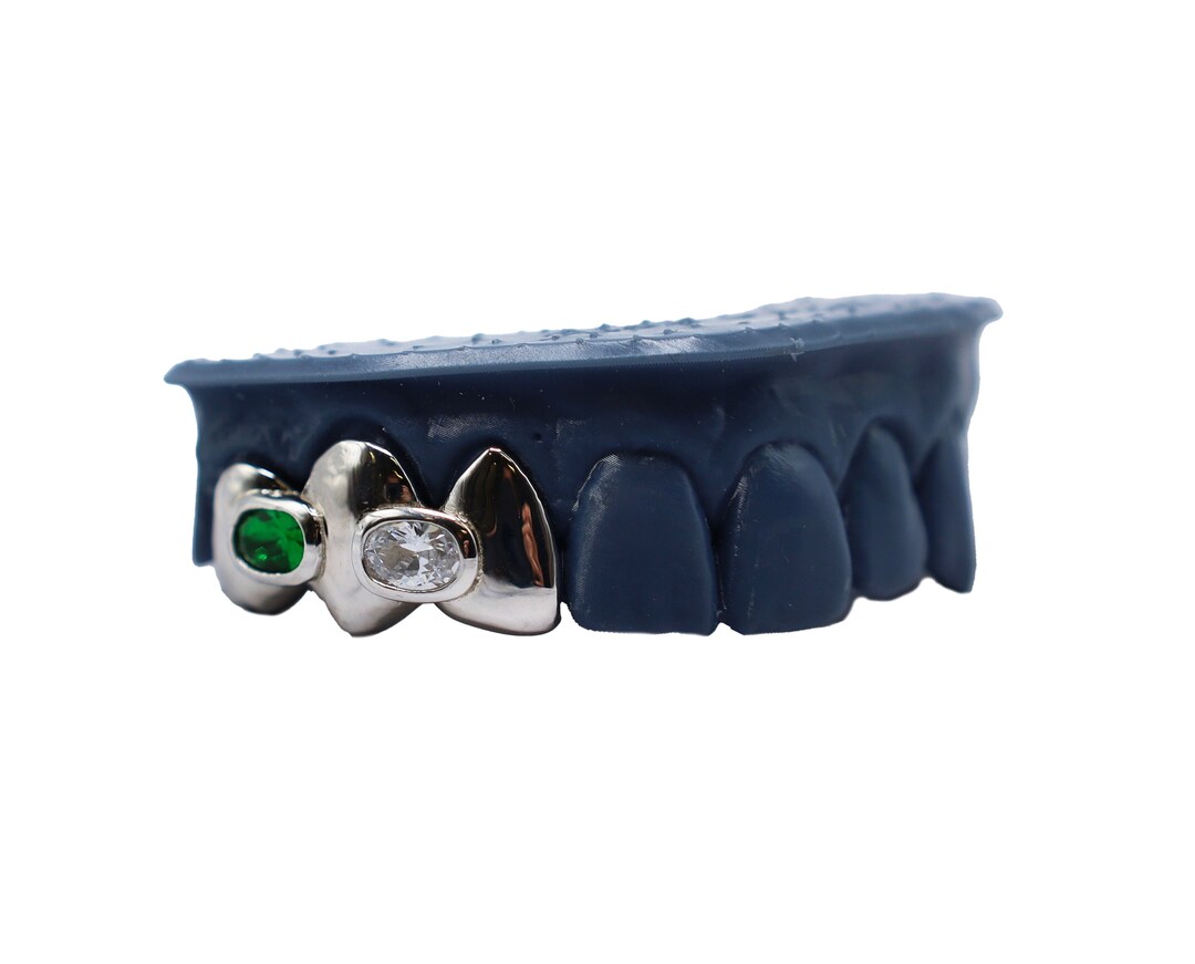 3 Tooth Emerald Cut Diamond and Emerald Gap Filler Grillz - Etsy