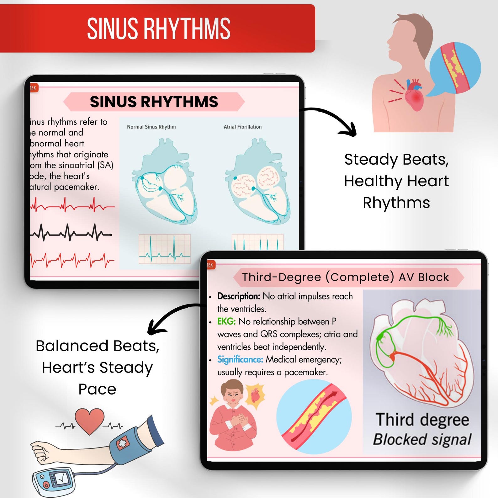EKG Heart Rhythm Flashcards: Medical Nursing Study Guide (digital ...