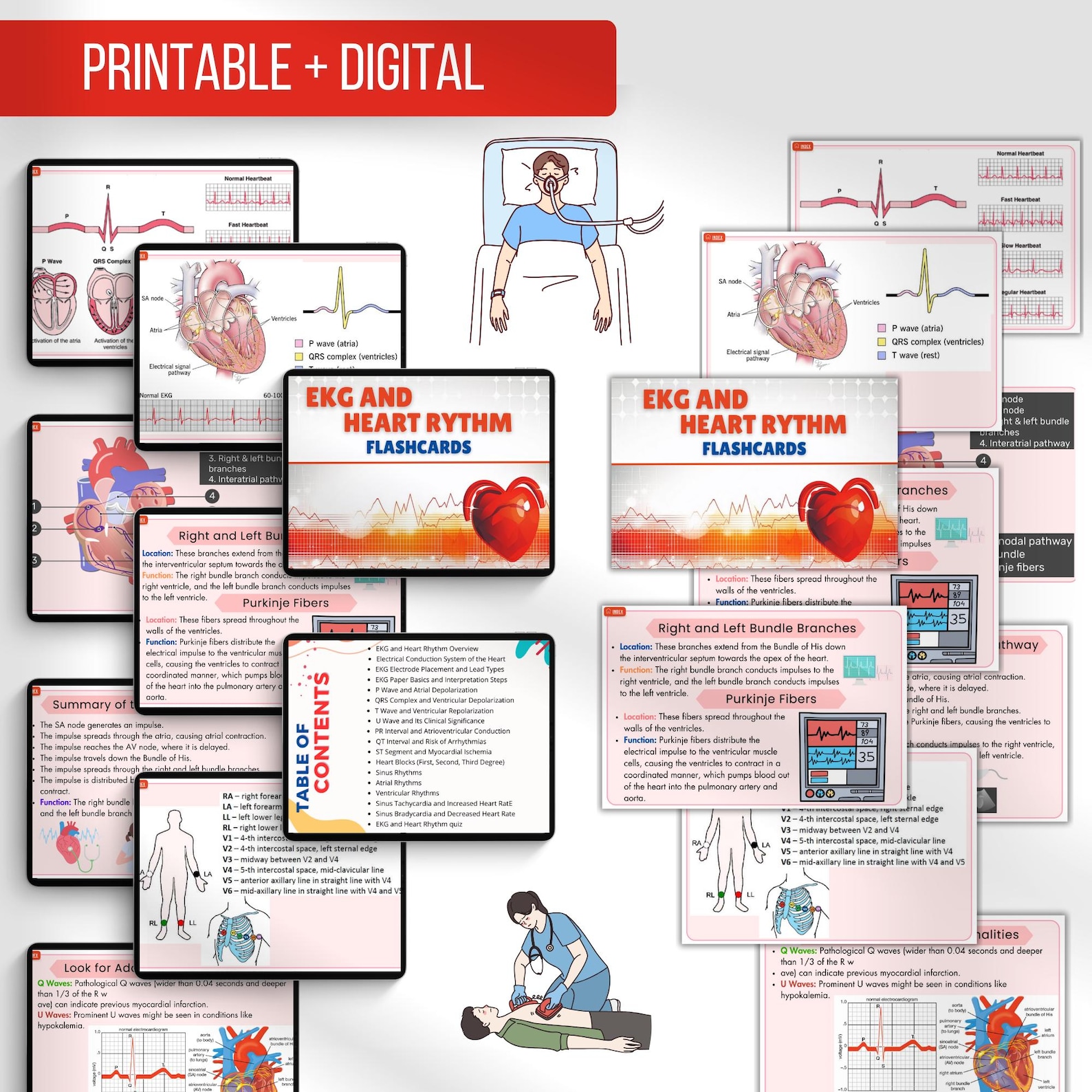 EKG Heart Rhythm Flashcards: Medical Nursing Study Guide (digital ...