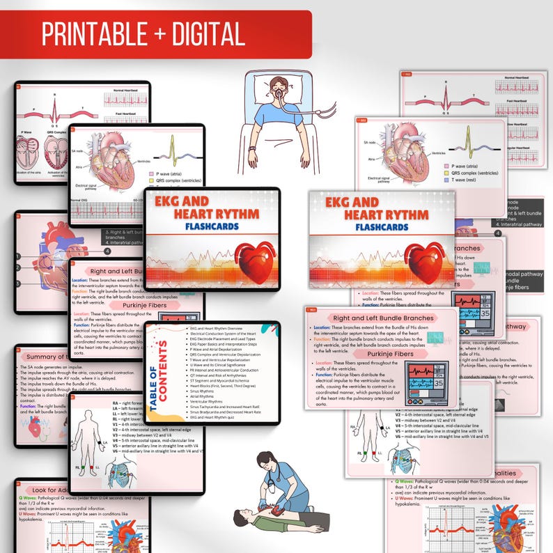 EKG & Heart Rhythm Flash Cards | Medical Nursing Study | Cardiac Nurse ...
