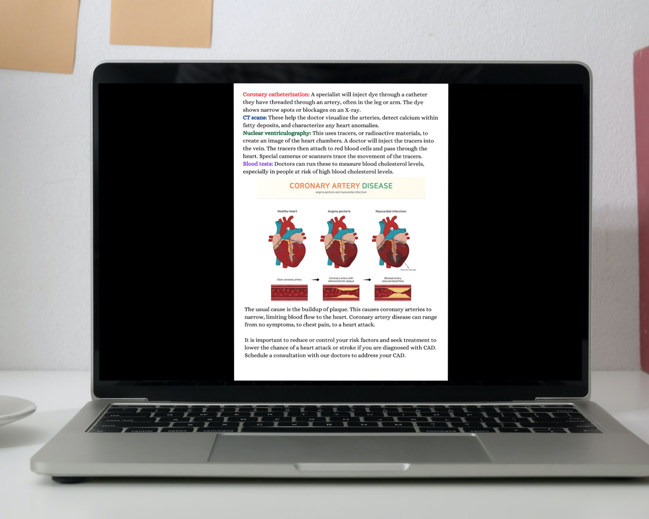 Cardiac Disorders Nursing Notes 2024, Cardiovascular System, Med Surg ...