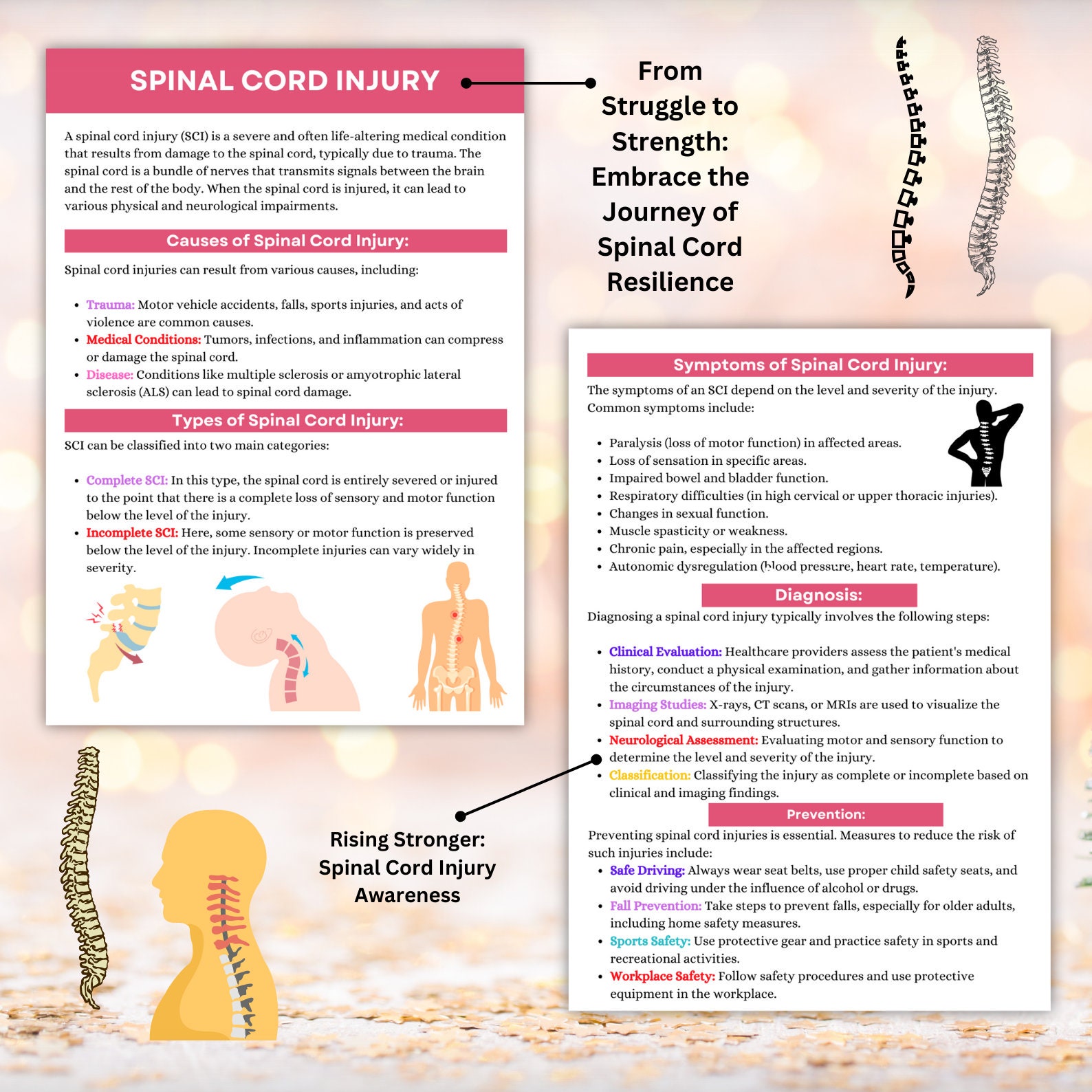 Neurological System Neuro Bundle Notes Med Surg Notes Pritnable Notes ...