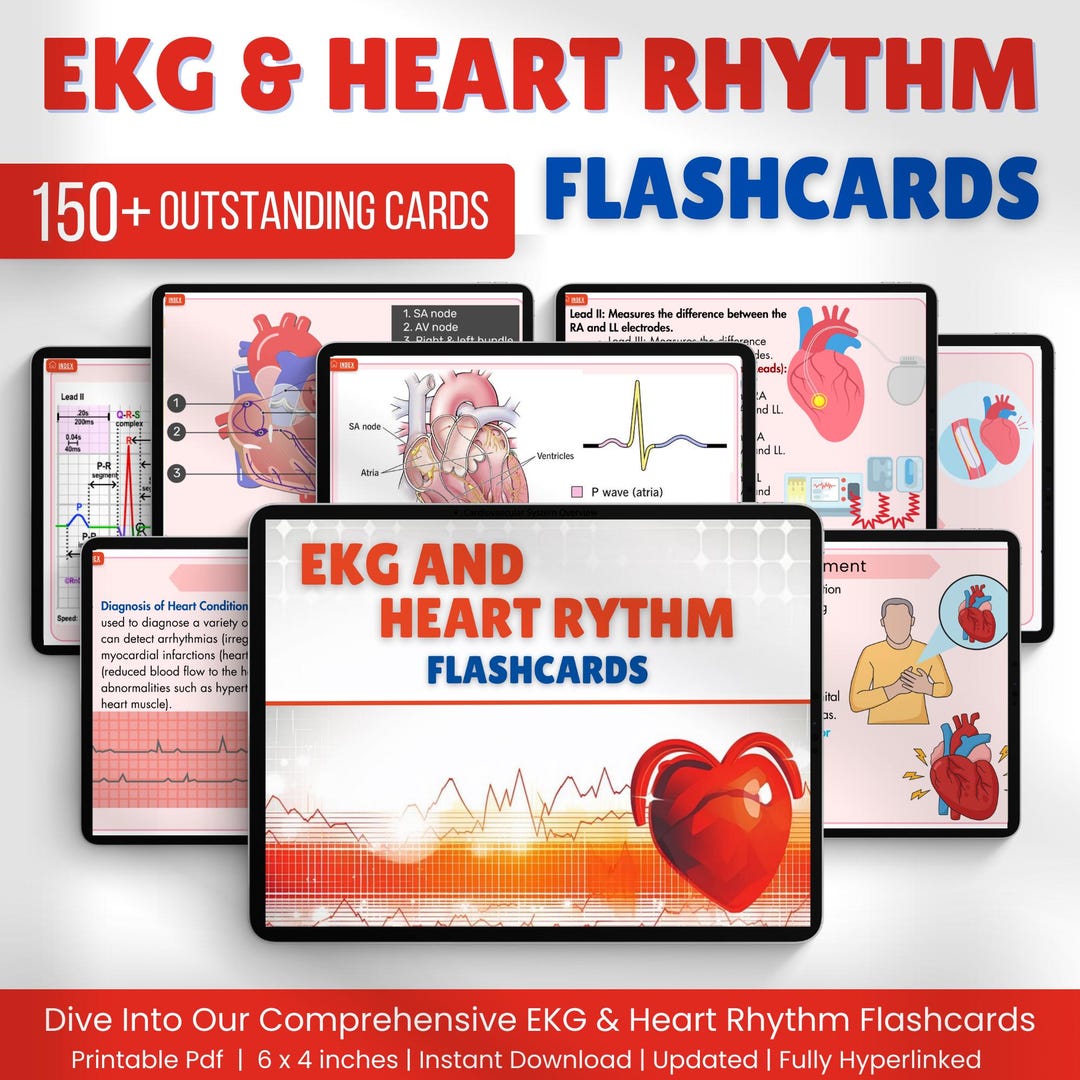 EKG & Heart Rhythm Flash Cards | Medical Nursing Study | Cardiac Nurse ...