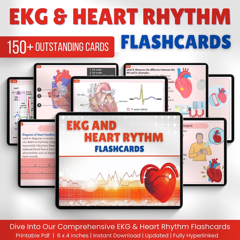 EKG Heart Rhythm Flashcards: Medical Nursing Study Guide (digital ...