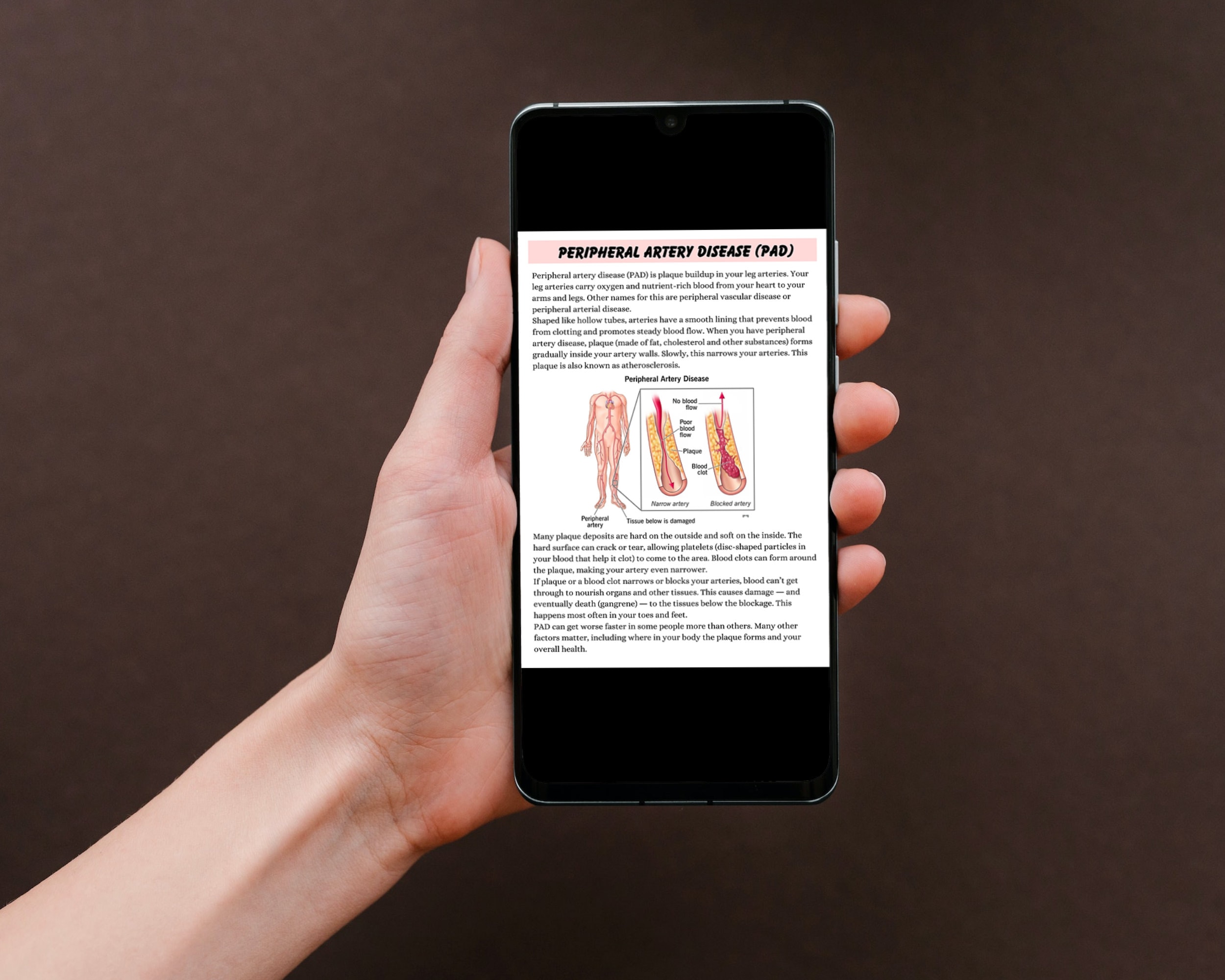 Cardiac Disorders Nursing Notes 2024, Cardiovascular System, Med Surg ...