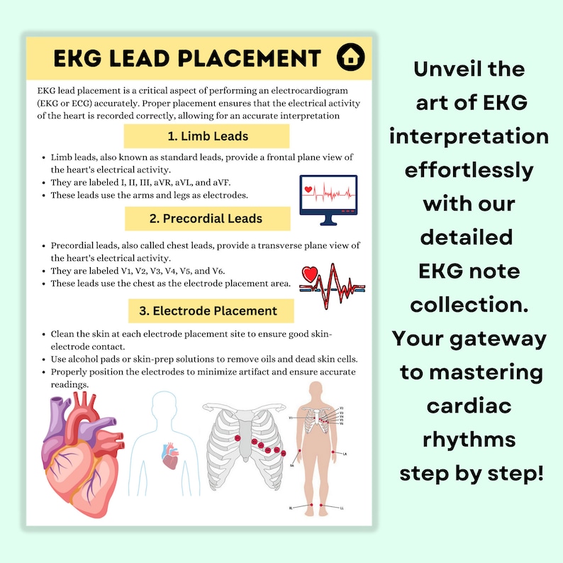EKG Study Guide for Nursing Students BLS/ACLS Rhythms, Interventions ...