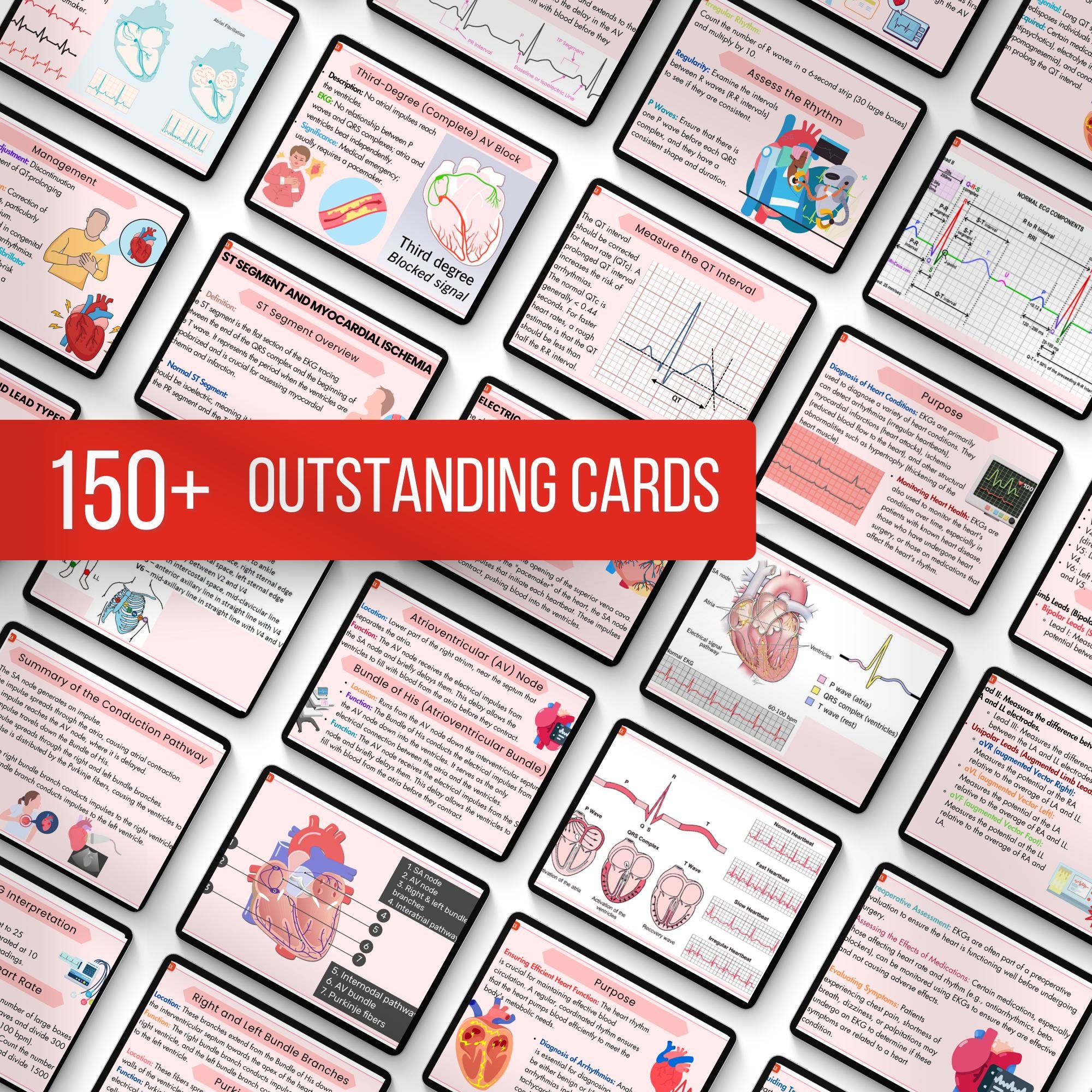 EKG & Heart Rhythm Flash Cards | Medical Nursing Study | Cardiac Nurse ...