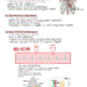Heartbeat Mastery: Your Ultimate Guide to ECG Expertise and Life-saving ...