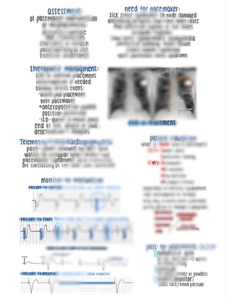 Pacing Perfection: Comprehensive Notes on Pacemakers, Rhythms ...