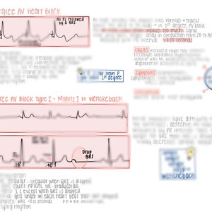 Heartbeat Mastery: Your Ultimate Guide to ECG Expertise and Life-saving ...