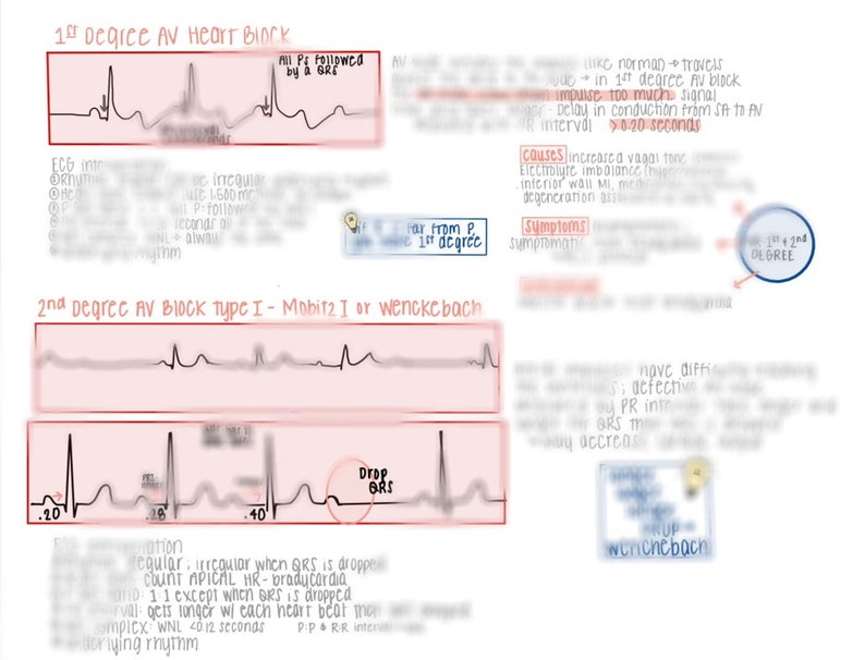 Heartbeat Mastery: Your Ultimate Guide to ECG Expertise and Life-saving ...
