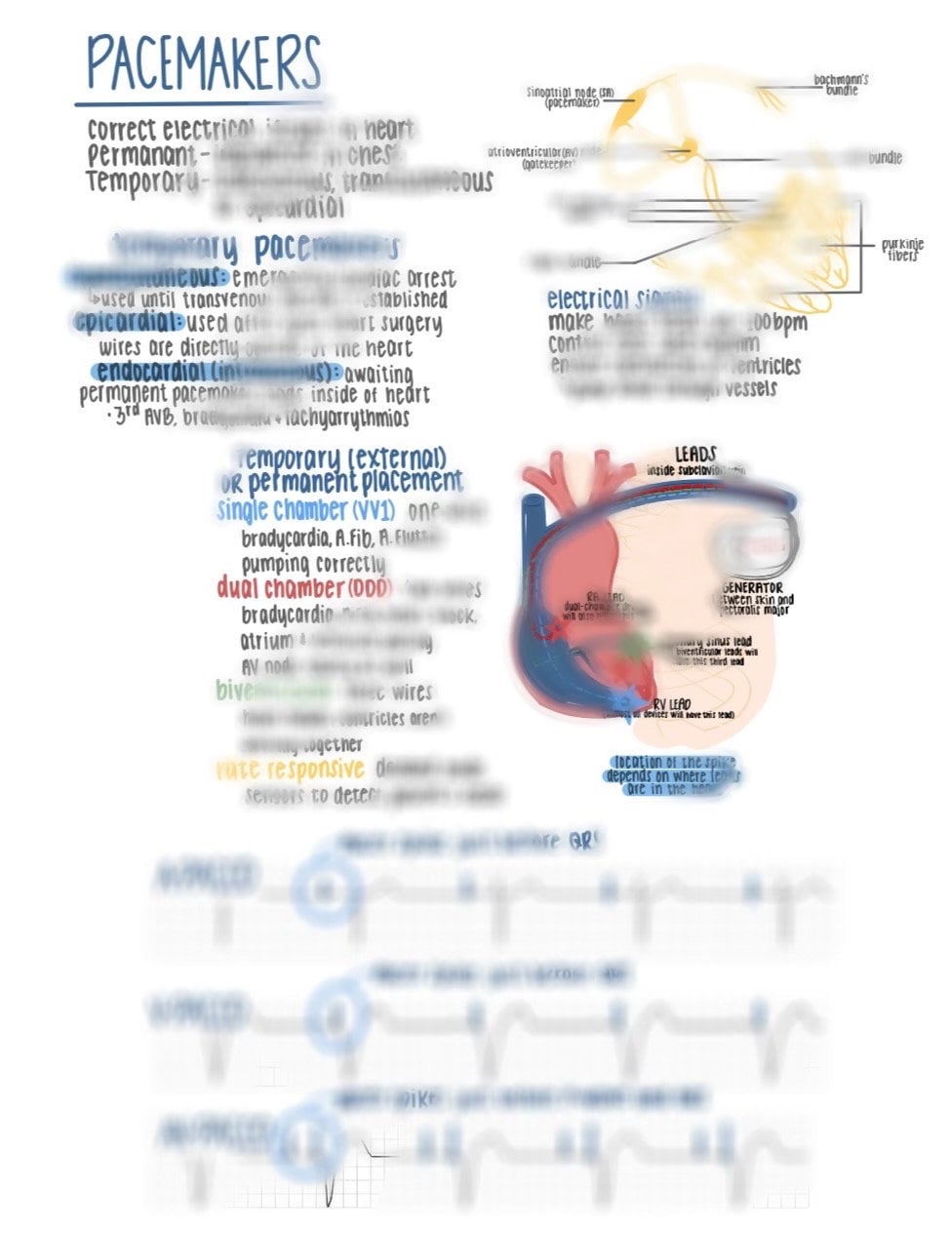Pacing Perfection: Comprehensive Notes on Pacemakers, Rhythms ...