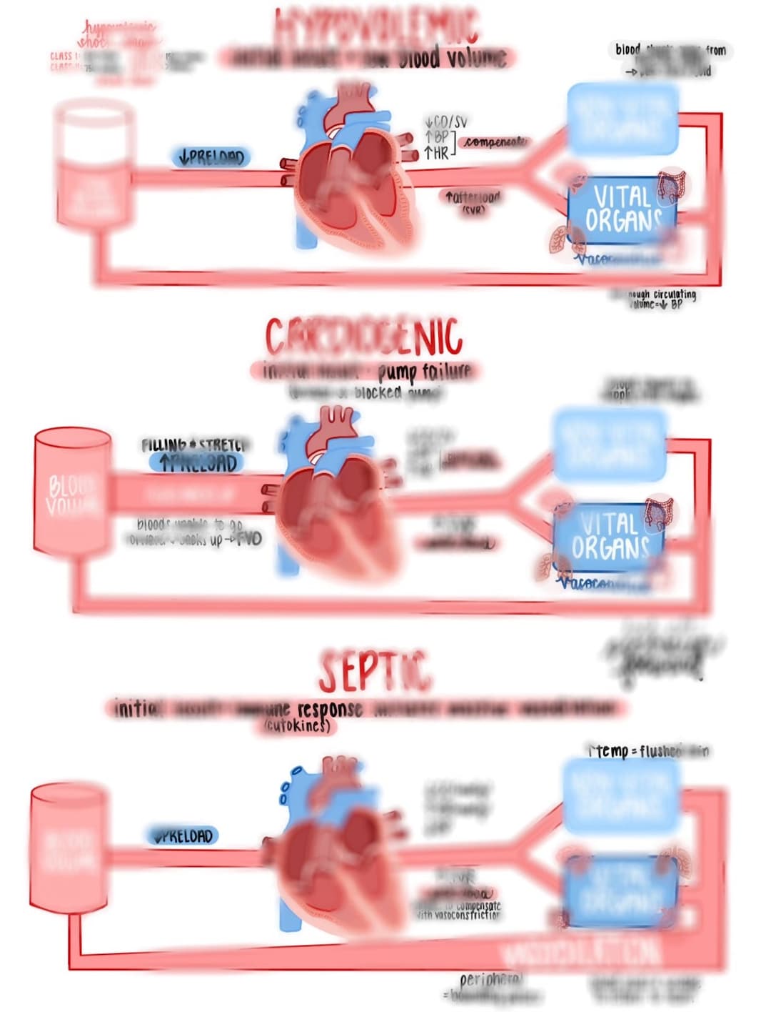 Comprehensive Shock Notes: Types, Stages, Causes, Treatments ...