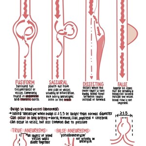 Aortic Aneurysms & Dissections: Comprehensive Nursing Notes on ...