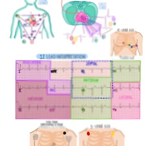 Heartbeat Mastery: Your Ultimate Guide to ECG Expertise and Life-saving ...