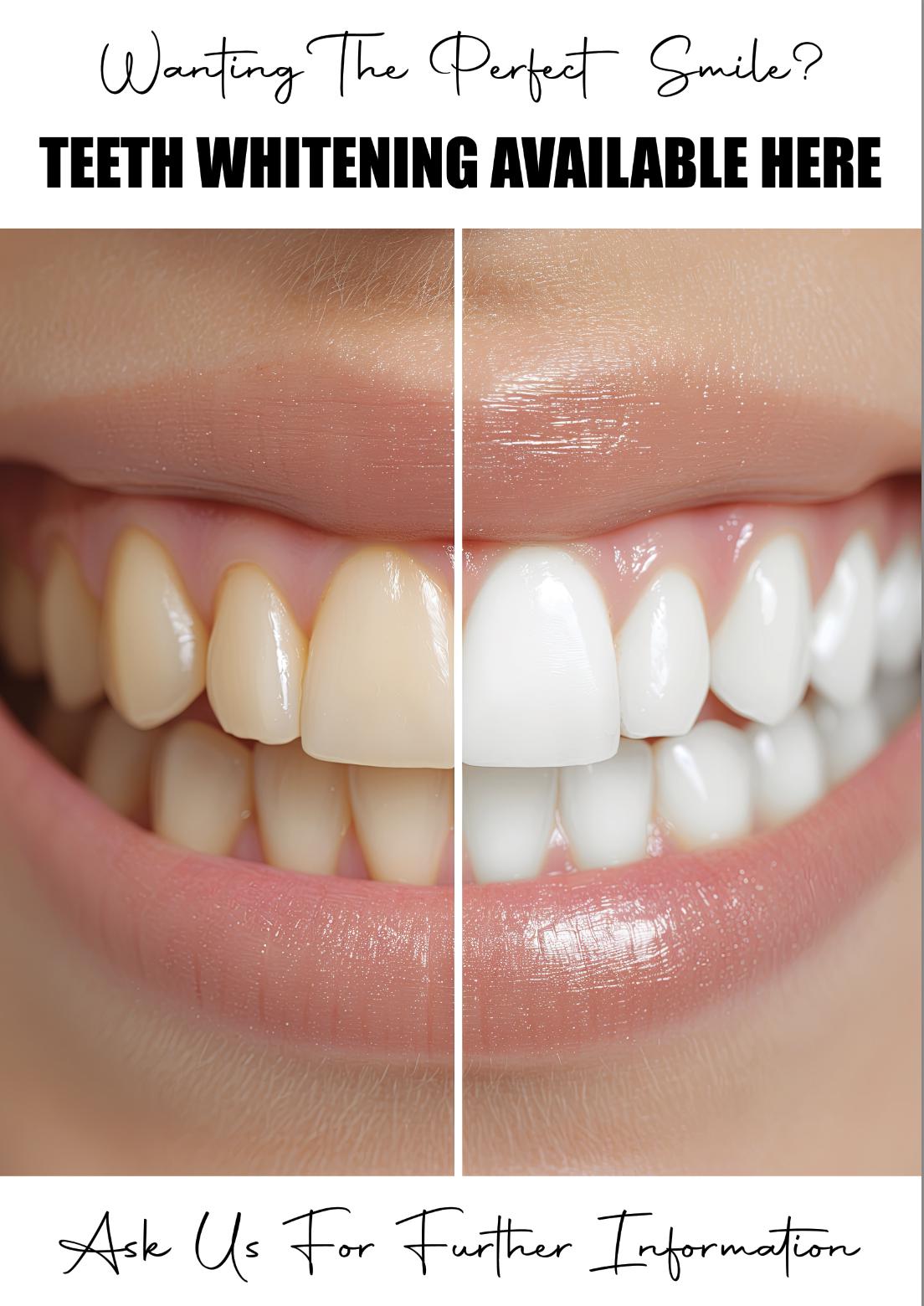 Teeth Whitening Whiter Smile Dentist Business Salon A Sizes Large ...