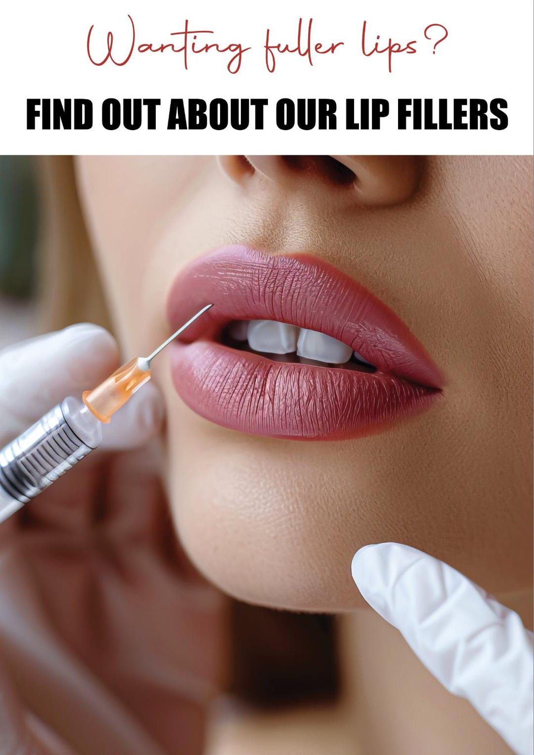 Lip Fillers Botox Available Here Laminated Poster Advertisement Sign ...