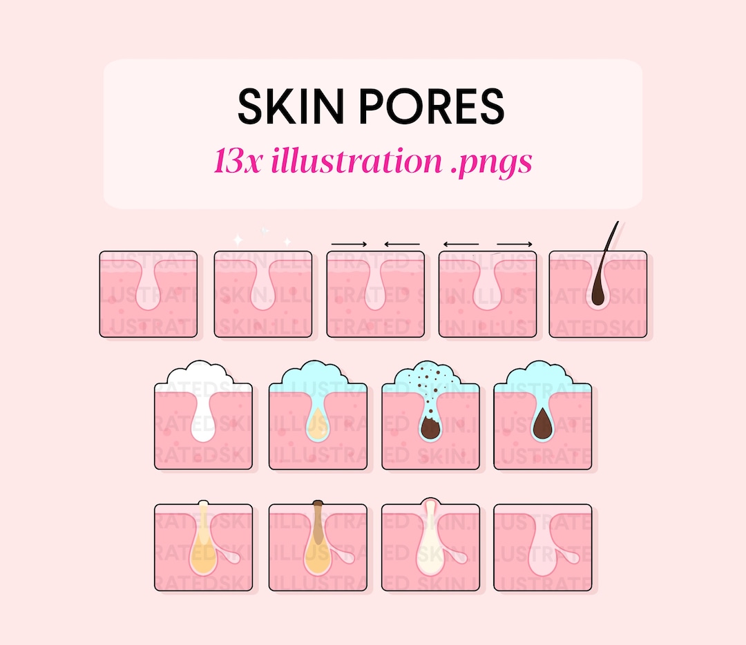 Pores Skin Cross Section Clip Art Illustrations for Estheticians - Etsy