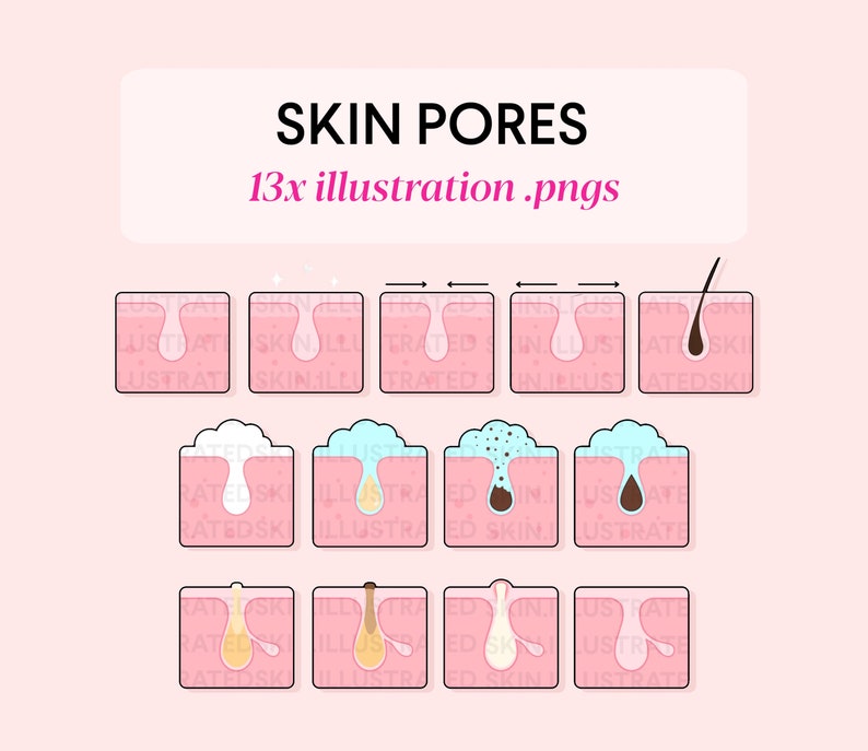 Pores Skin Cross Section Clip Art Illustrations for Estheticians - Etsy