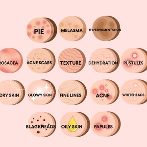 Skin Conditions Illustration Pack Esthetician, Aesthetician Graphics by ...