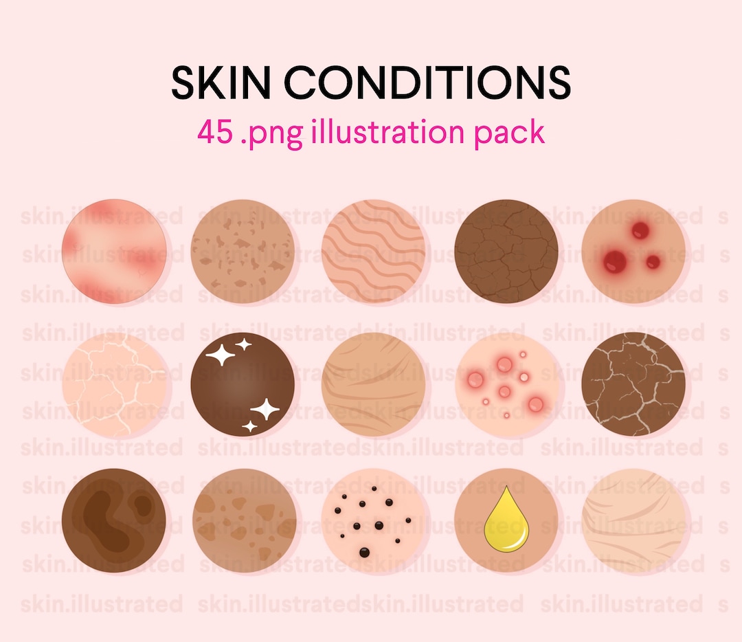 ESTHETICIAN Skin Problems Icon Pack | Esthetician Illustration - Etsy