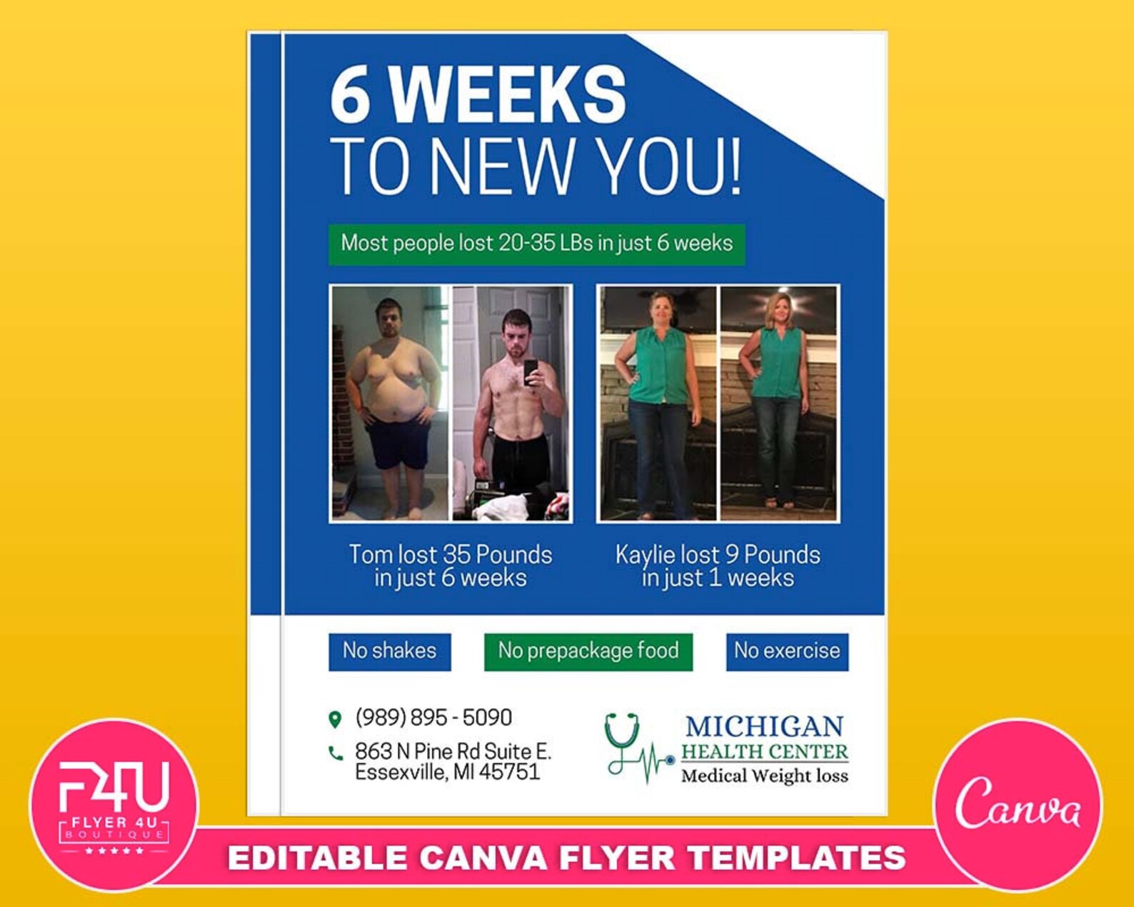 Before and After Weight Loss Flyer DIY Before and After | Etsy