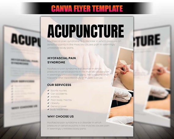 Acupuncture Flyer DIY Canva Acupuncture Flyer Template | Etsy