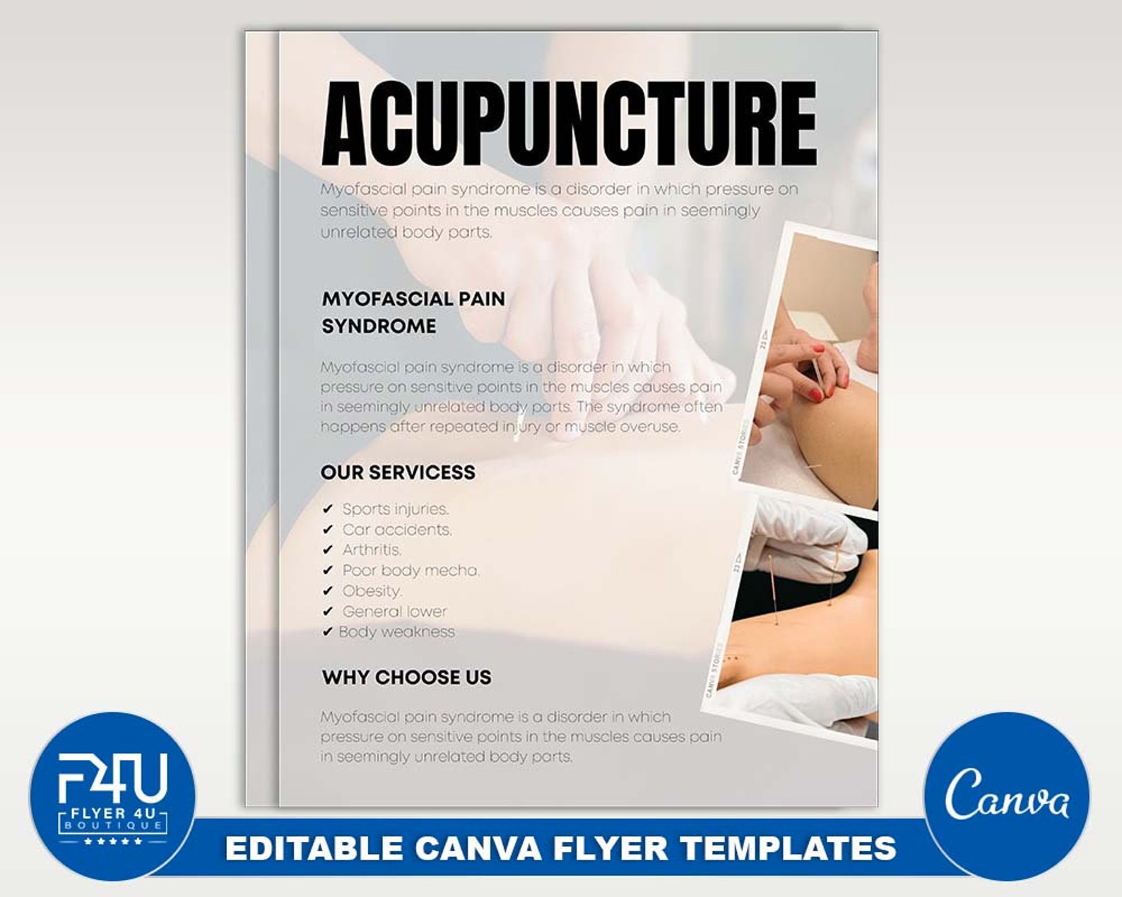 Acupuncture Flyer, DIY Canva Acupuncture Flyer Template 2022,editable ...