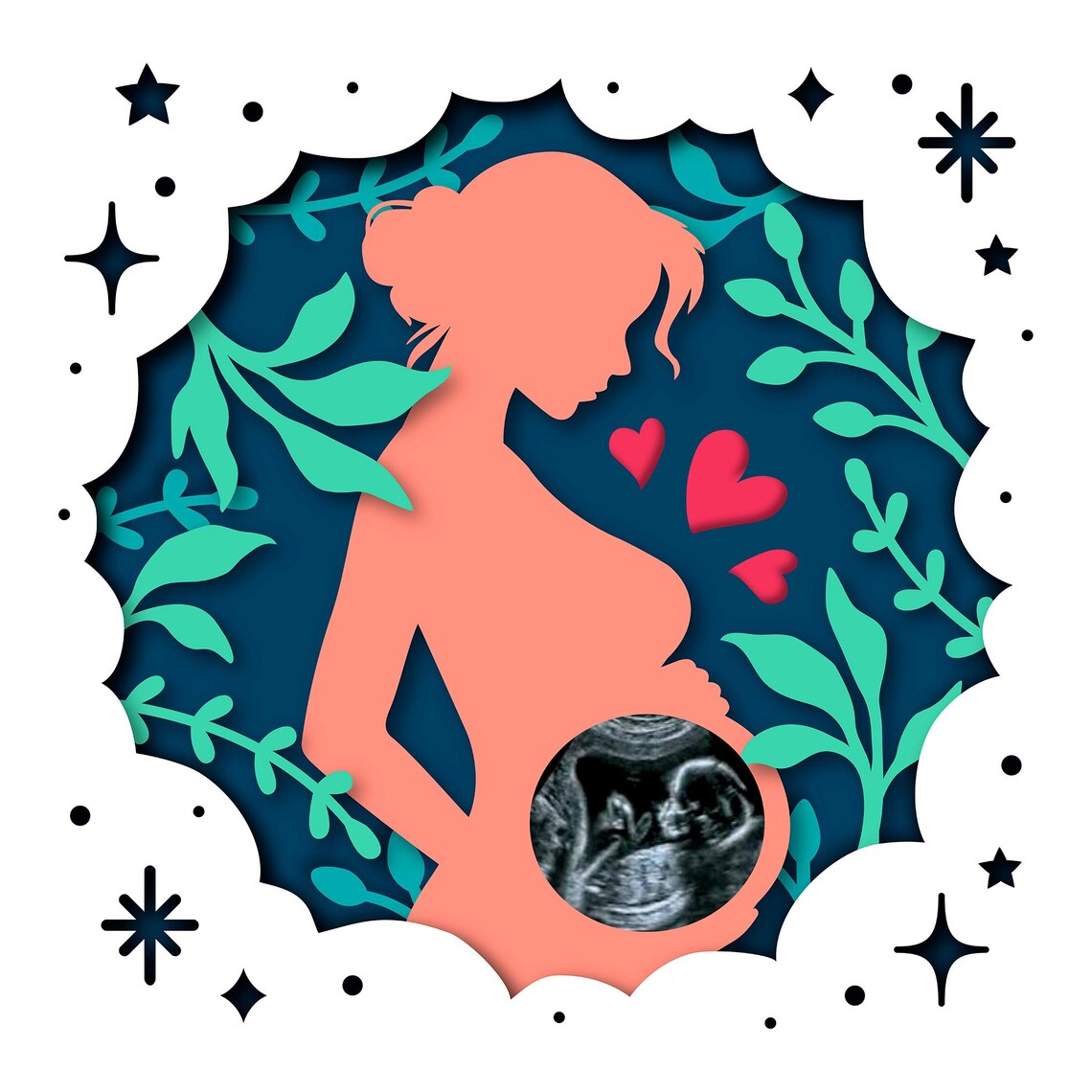 Baby Ultrasound 3D Shadow Box SVG | Pregnancy Cut File | Layered Cricut ...