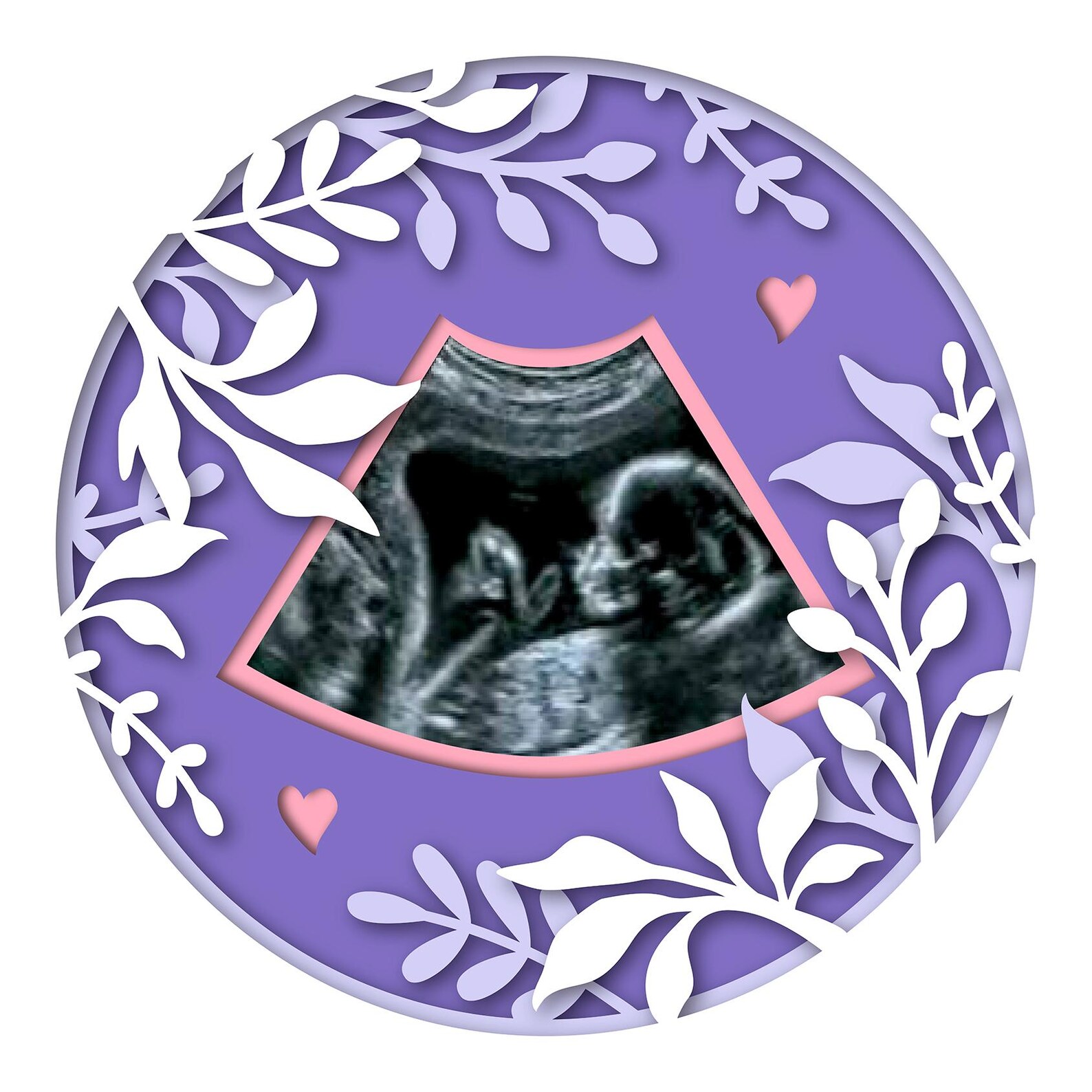 Baby Ultrasound 3D Shadow Box SVG | Pregnancy Cut File | Layered Cricut ...
