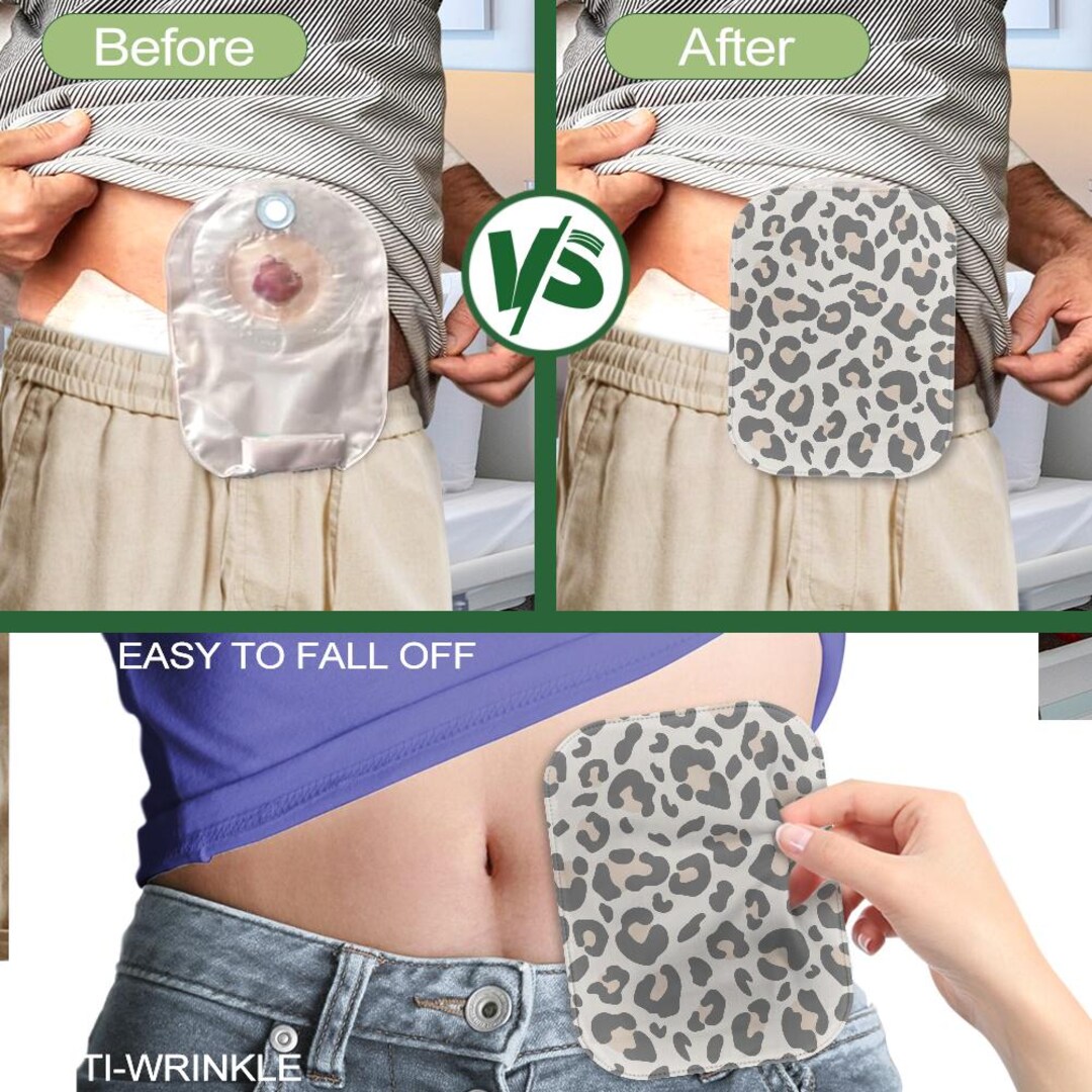 Ostomy Bag Covers Catheter Bag Cover Urine Drain Bag Catheter Supplies ...