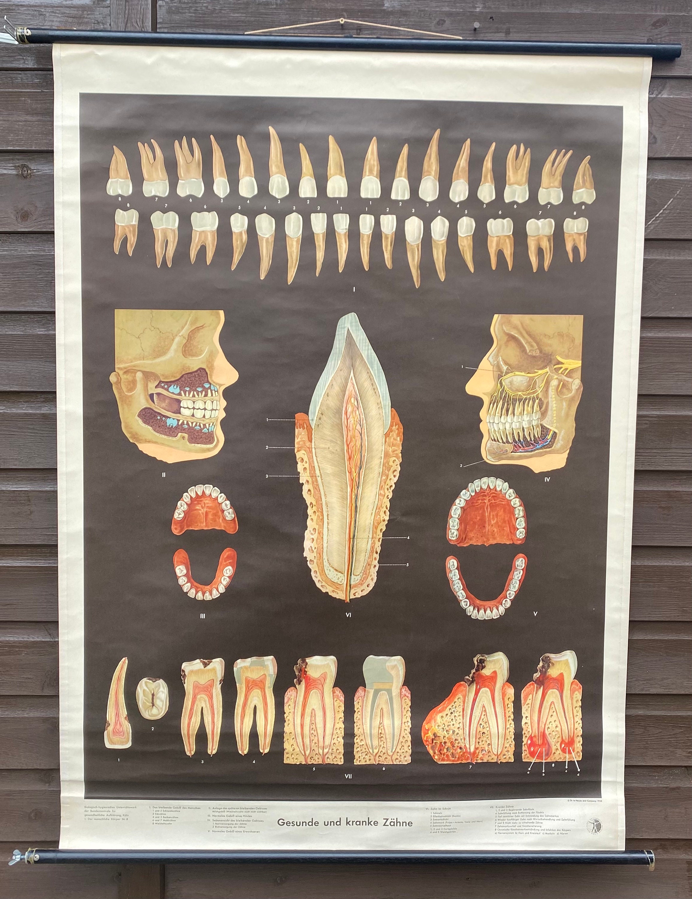 Vintage 1953 Medical Wallchart Human Teeth Dentist Dentistry Poster ...