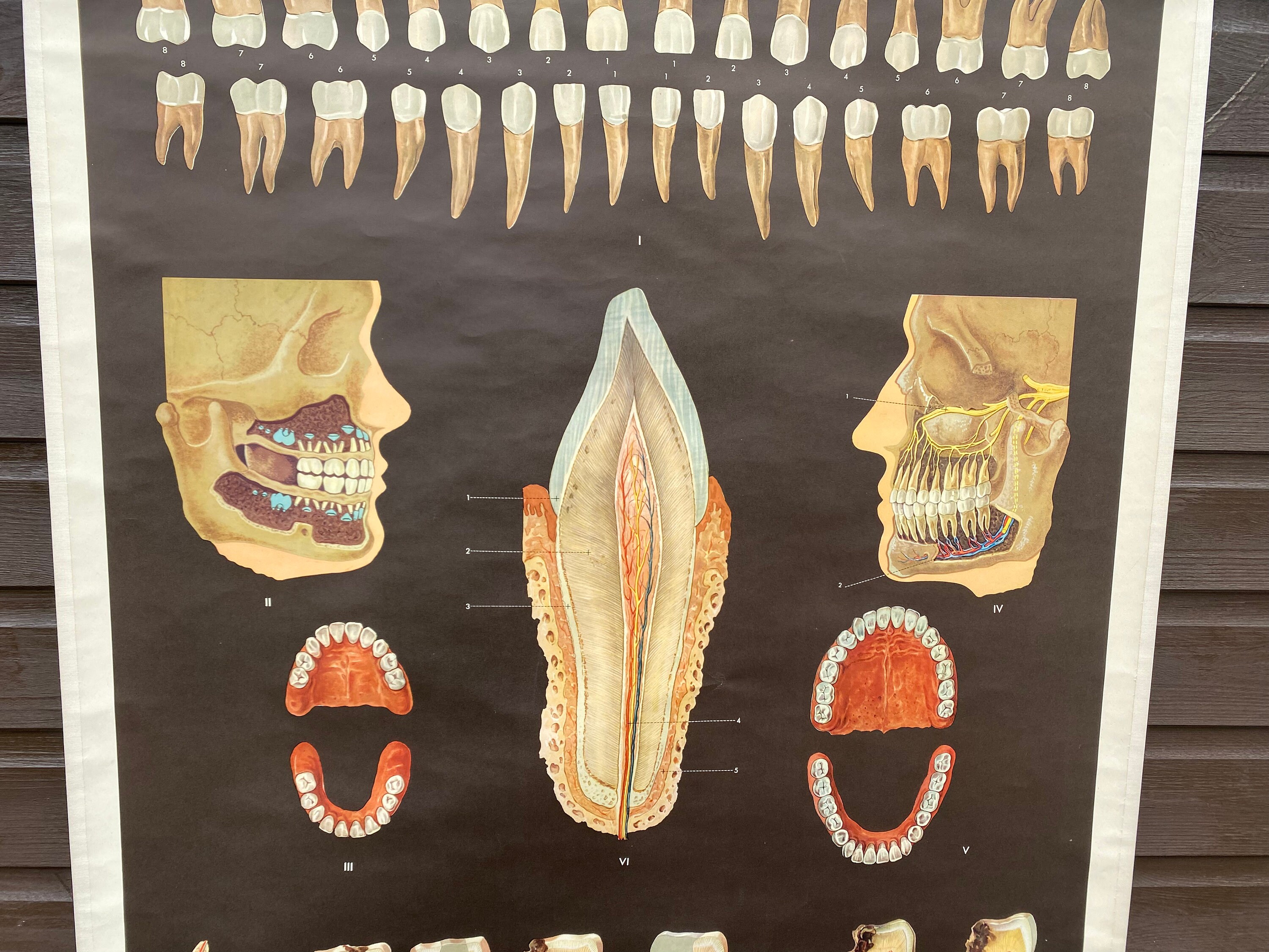 Vintage 1953 Medical Wallchart Human Teeth Dentist Dentistry Poster ...