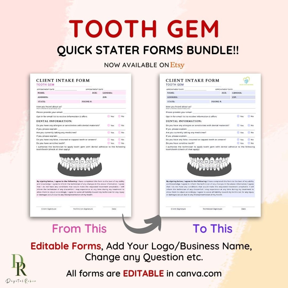 Tooth Gem Consent Form, Tooth Gem Intake Form, Tooth Gem Forms, Tooth ...