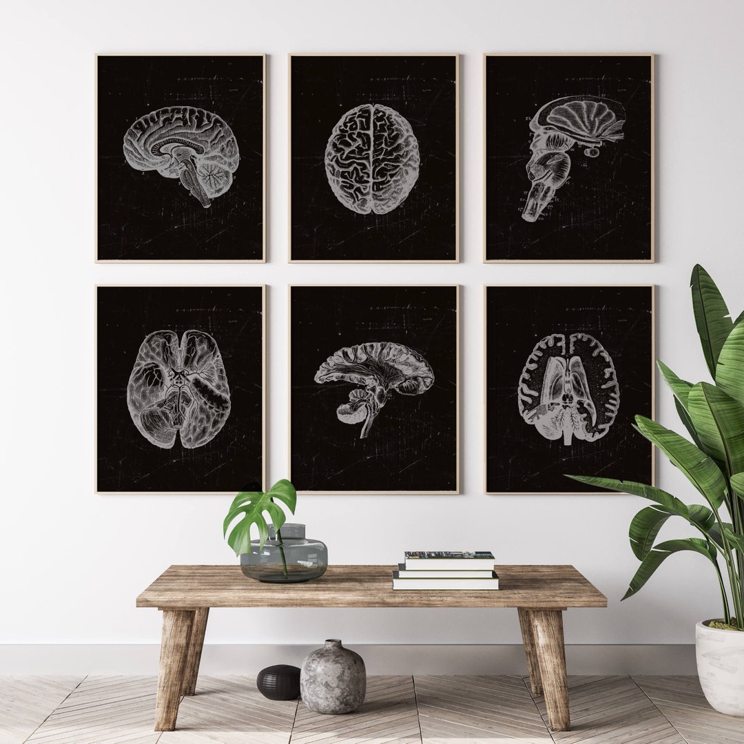 Black and White Brain Wall Art, Anatomy Print Set, Neurological ...