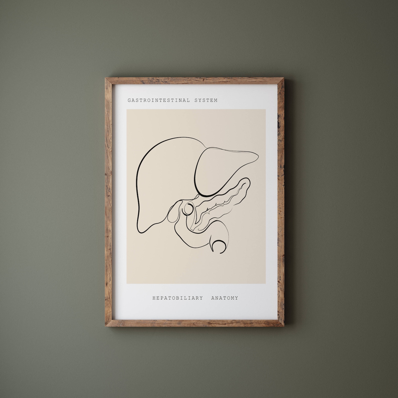 Liver Art Anatomy Poster Liver Transplant Gift - Etsy