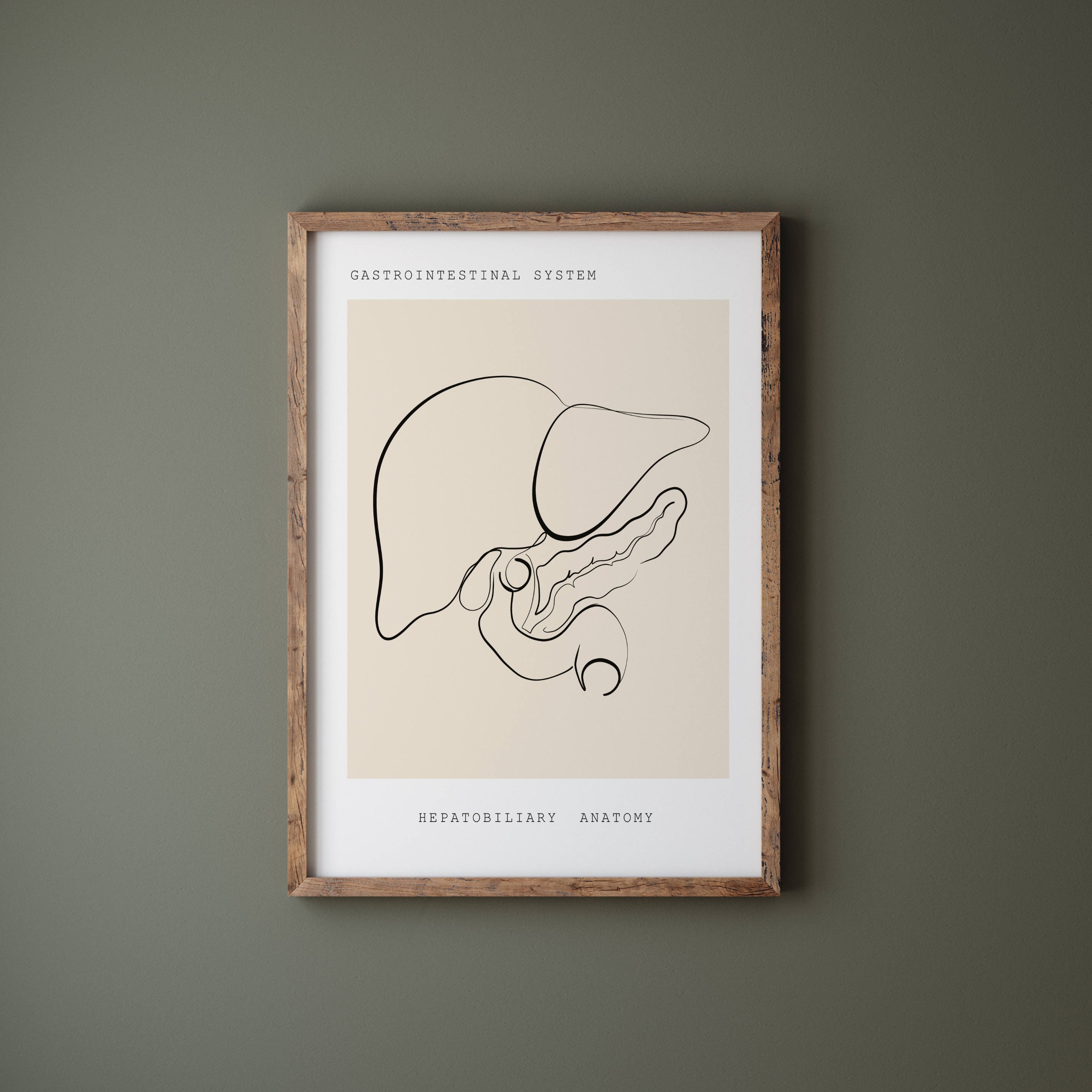 Liver Art, Anatomy Poster, Liver Transplant Gift, Gastrointestinal ...