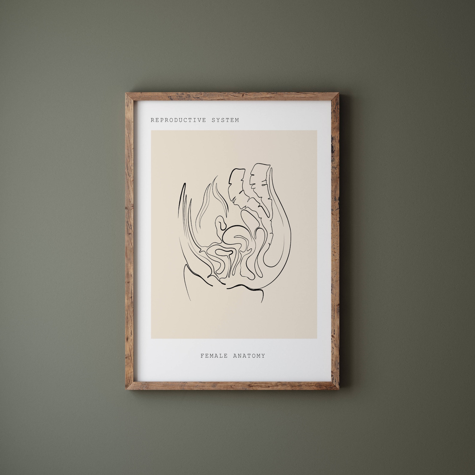 Anatomy Wall Art, Reproductive System Art, Genitourinary System ...